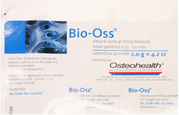 Bio-Oss | あい歯科